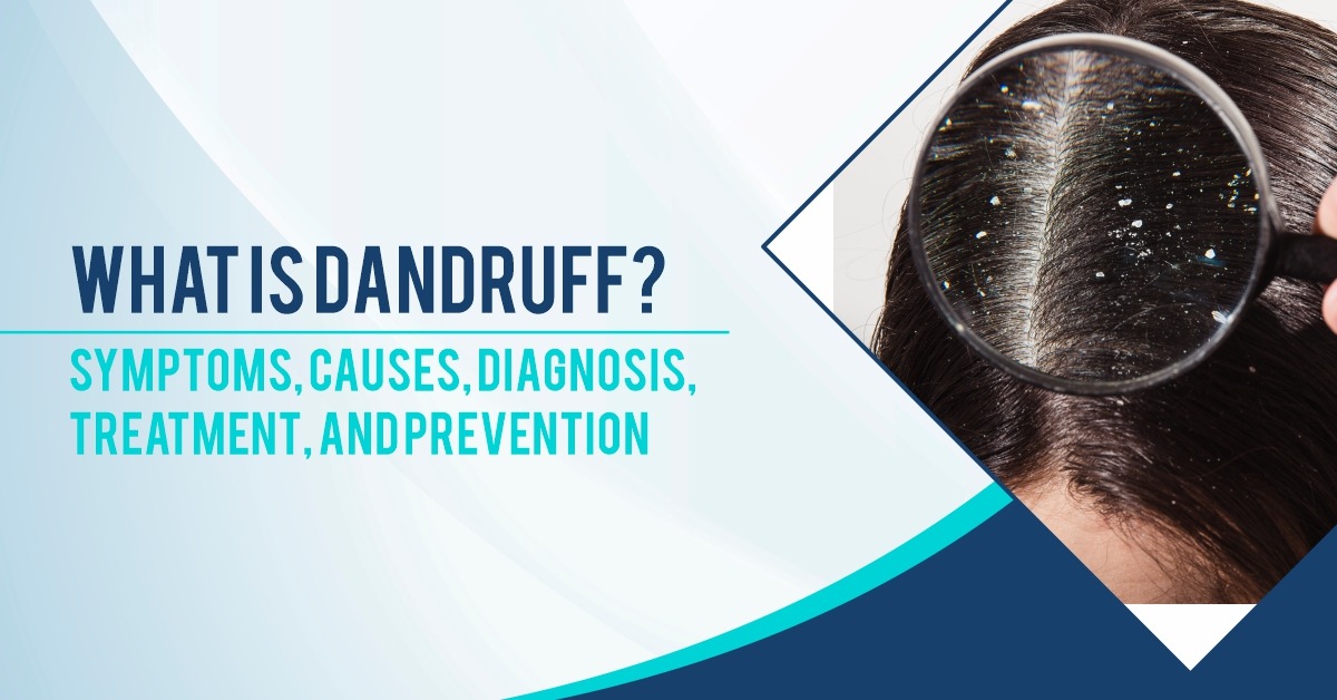 Dandruff Symptoms Causes Diagnosis Treatment And Prevention